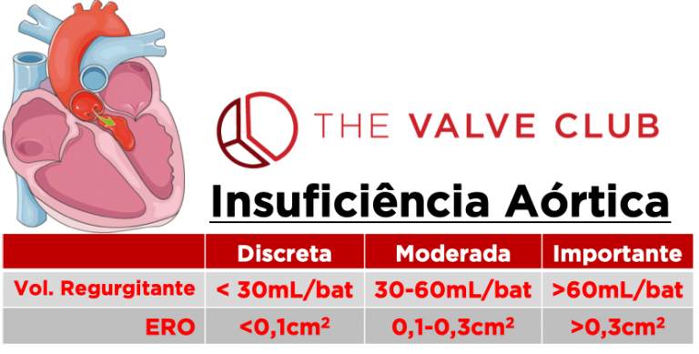 Aprenda sobre o Insuficiência Aórtica - Classificação Clínico ...