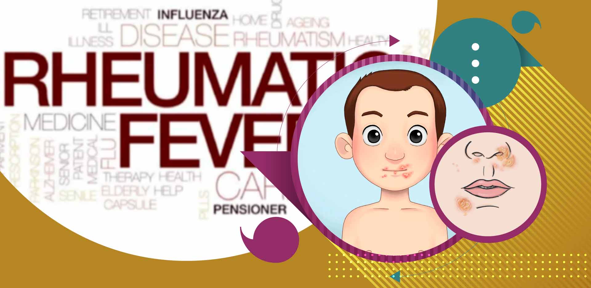 Infecção de pele e Febre Reumática - The Valve Club