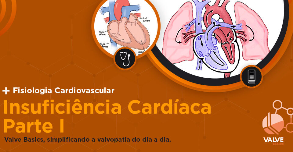 Aprenda sobre o Insuficiência Aórtica Clínico - [thevalveclub]