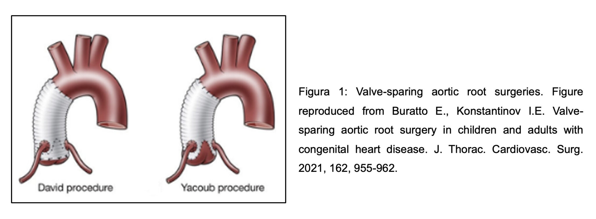 David e Yacoub - [thevalveclub]